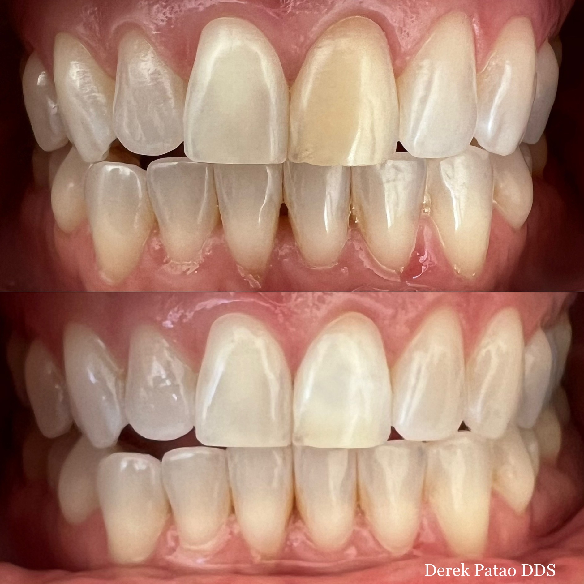 Services – Patao Dental – Glendale Dentist